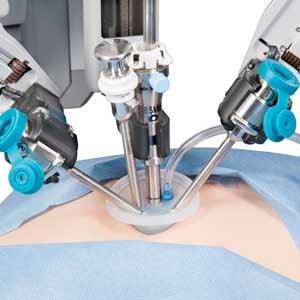 da Vinci Robotic Non-Invasive Surgical Hysterectomy | Waukesha, WI